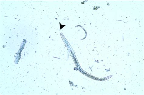 Paralysed Toxocara Canis Larva The Nontreated Eggs Were Incubated For