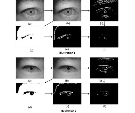 Fig A1 Proposed Edge Map Generation Technique For Pupil Detection