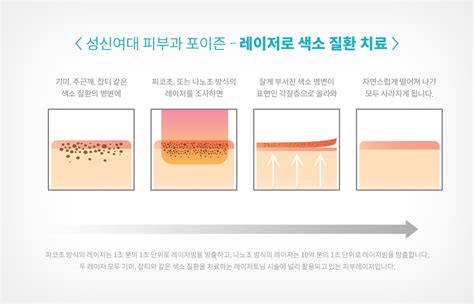 ﻿성북구피부과 기미는 피부관리로 제거할 수 없고 레이저로 분해해서 제거해야 합니다 성신여대 포이즌 피부칼럼 성신여대피부과 포이즌의원