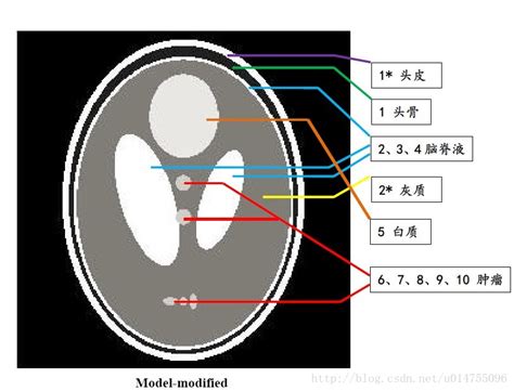 基于二维傅里叶变化法的mri成像原理的matlab仿真（2）为什么mri要二维dft Csdn博客
