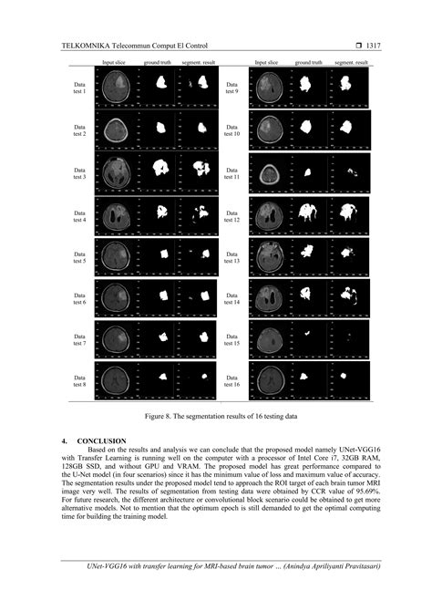 Unet Vgg16 With Transfer Learning For Mri Based Brain Tumor Segmentation Pdf