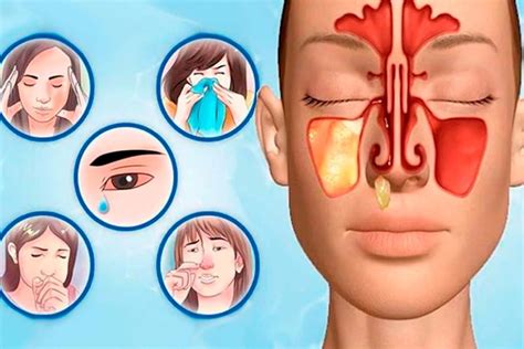 Ксилен капли в нос инструкция по применению цена