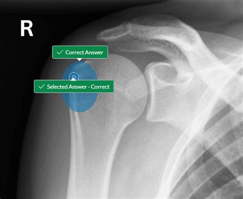 Exam 4 Anatomy Labeling Pt 2 Diagram Quizlet