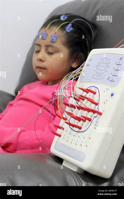 Electroencephalogram A Test That Measures The Brains Electrical