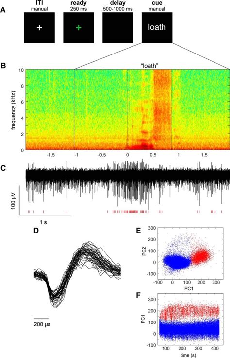 Subthalamic Nucleus Neurons Differentially Encode Early And Late