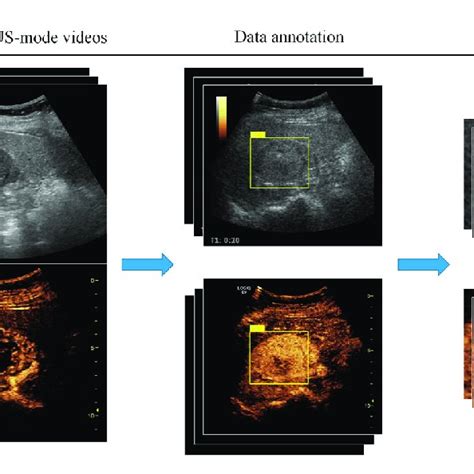 Data Annotation And Preprocessing Download Scientific Diagram