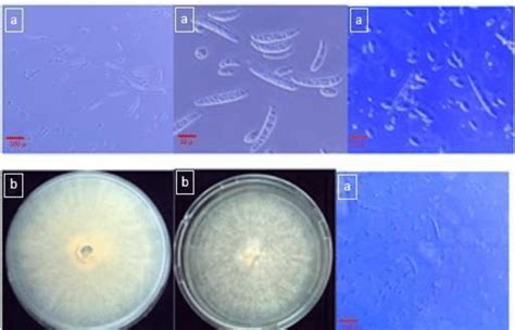 F Solani Isolate A Microconidia And Macroconidia Magnification For