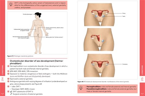 Pocket Obstetrics And Gynaecology 2024 Compendium Medicine