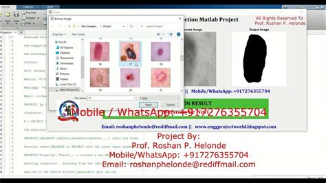 Skin Disease Detection Using Image Processing With Source Code Matlab Project Skin Disease