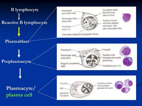 Plasma Cell Disorders Pptx