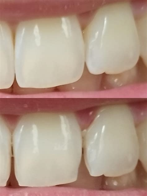 Ipr Just Did Ipr This Morning Is It Me Or This Is Really Bad Details In The Comments R