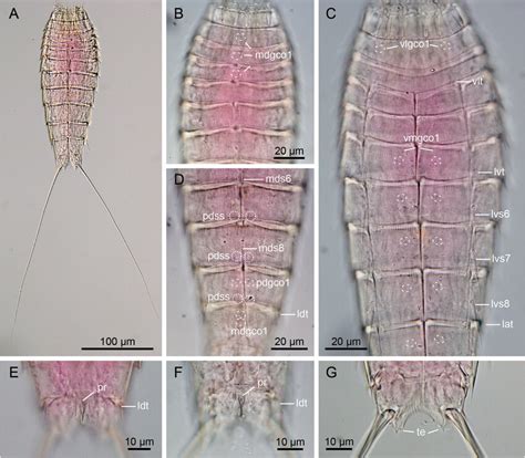 Light Micrographs Showing Overview And Details Of Echinoderes Gandalfi Download Scientific