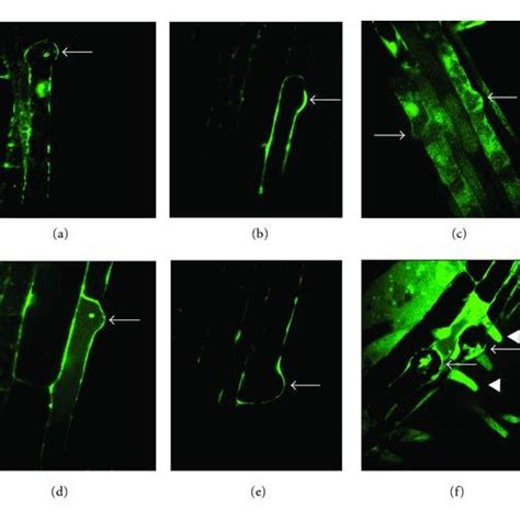 Nbt Staining Indicating The Production Of Superoxide Radical In Root