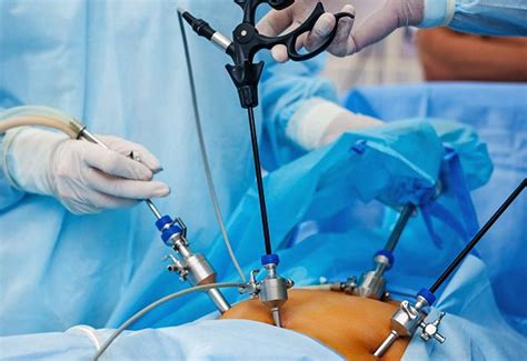 What Gas Is Used In Laparoscopic Surgery At Helen Williamson Blog