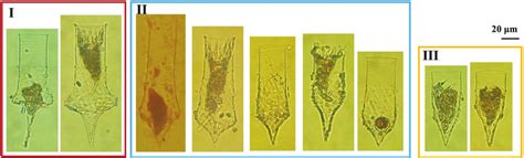 Photographs Of Polymorphic Codonellopsis Gaussi Types I Individuals