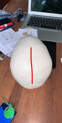 Axial Skeleton Quiz With Pics Flashcards Quizlet