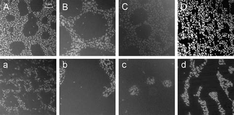 Coverage Of Pseudomonas Aeruginosa On The Four Materials A And Download Scientific Diagram