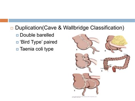 Operative Steps In Open Appendicectomy Pptx