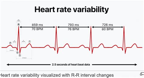 Nhịp Tim 76 Bpm Là Gì Hiểu Đúng Về Nhịp Tim Bình Thường Và Sức Khỏe Tim Mạch