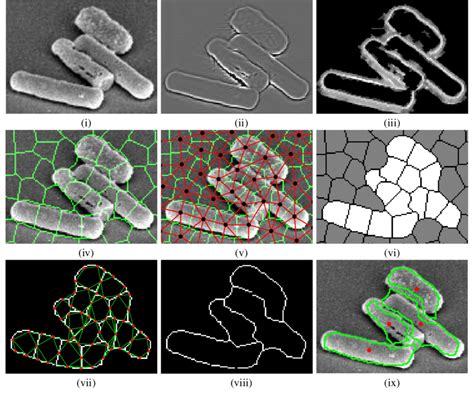Application Of Detcic To A Clostridium Difficile Cell Image Acquired