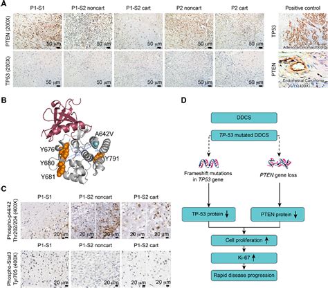 Figure 1 From Targeted Next Generation Sequencing Of Dedifferentiated Chondrosarcoma In The