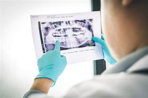 ai dental assistant reads x rays with near perfect accuracy bite magazine