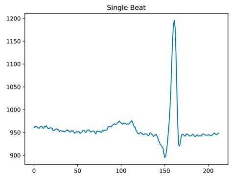 An Electrocardiogram Classification Using A Multiscale Convolutional Causal Attention Network