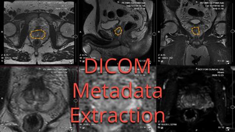 Dicom Metadata Extraction A Comprehensive Guide For Medical Imaging