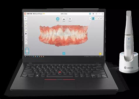 Accelerate With Dexis Intraoral Scanning Solutions Dexis