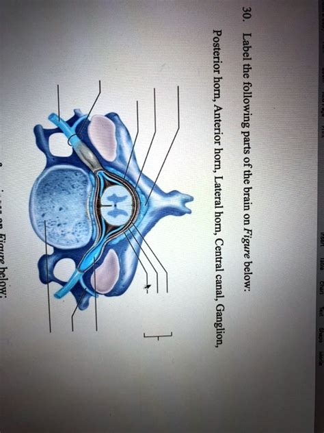 SOLVED: Posterior horn, Anterior horn, Lateral horn, Central canal ...