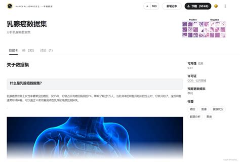 【数据集】全网最全的常见已公开医学影像数据集 医学图像公开数据集 csdn博客