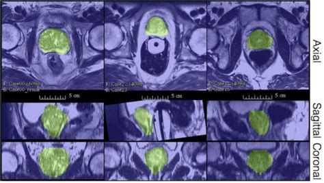 Qualitative Results Of Promise 2012 Data Set 5 Conclusion And