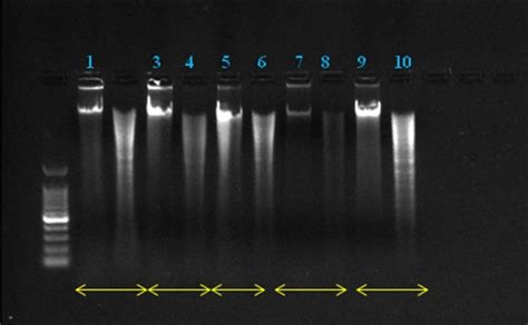 Agarose Gel Of Undigested And Digested Dna Extracted From Lesser Yam