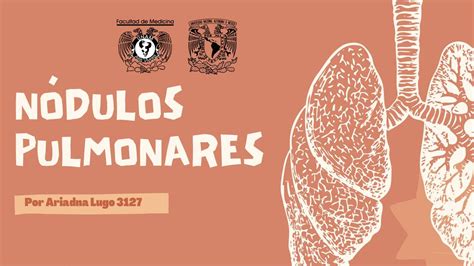 Resúmenes De Nódulo Pulmonar Descarga Apuntes De Nódulo Pulmonar