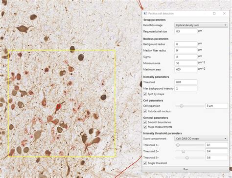 Qupath Cell Detection Not Detecting Positive Cells On Ihc Usage