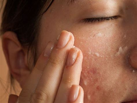 How To Shrink Large Pores 7 Beauty Tips