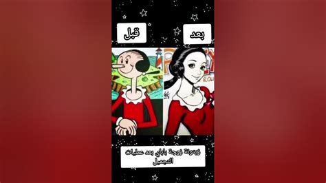 زيتونة زوجة باباي بعد عمليات التجميل Youtube