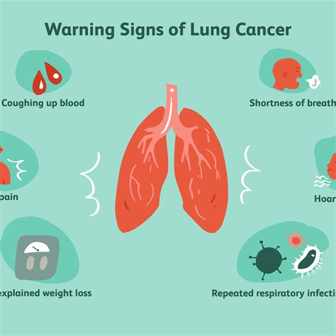 Cough And Cervical Cancer At Joyce Mckenzie Blog