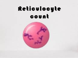 HOW TO DO RETICULOCYTE COUNT TEST