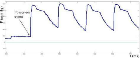 10 Ibp Emulated Signal Measured With Tomorrow Patient Monitor System Download Scientific