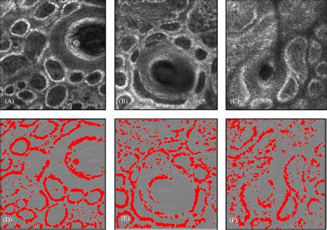 Dermal Epidermal Junction Subject 4 Representative Original Download Scientific Diagram