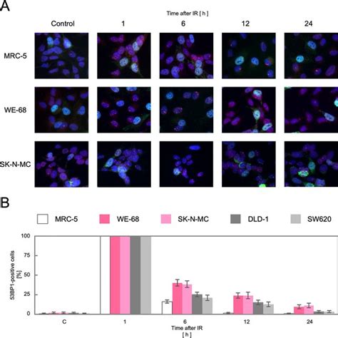 Expression Microarray Analyses Of Tl⁺ Human Tumor Cell Lines Using An
