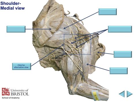 Canine Muscles Shoulder Medial Diagram Quizlet