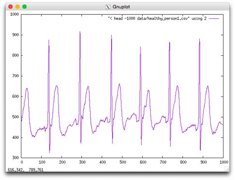 ECG HTM Devpost