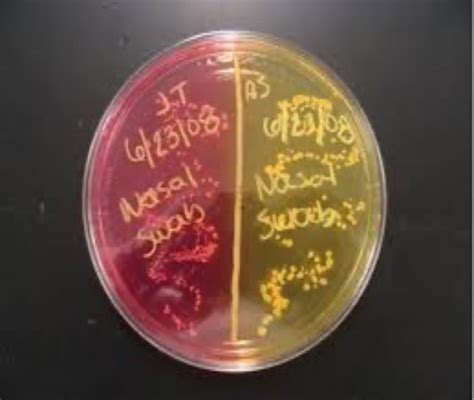 Microbio Lab Practical Flashcards Quizlet