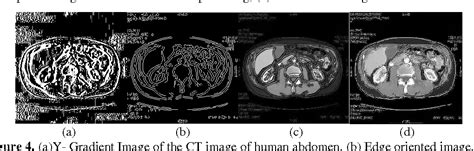 Figure 1 From Ct Image Denoising Technique Using Ga Aided Window Based