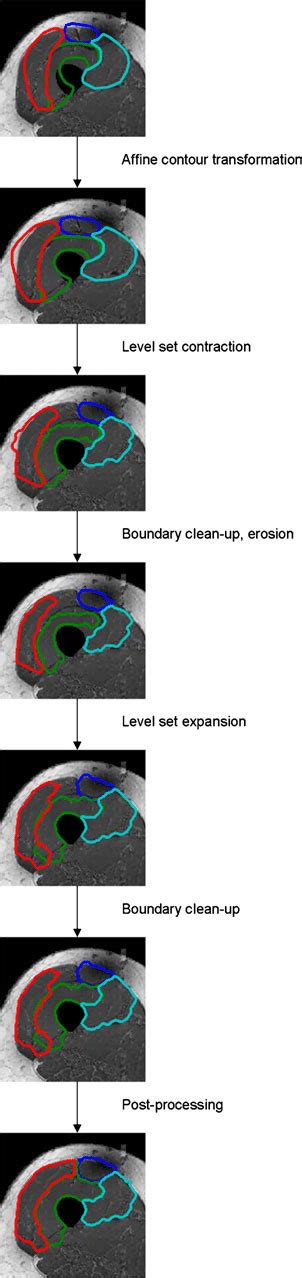 Segmentation Example From Initial Template Contour Alignment Through Download Scientific