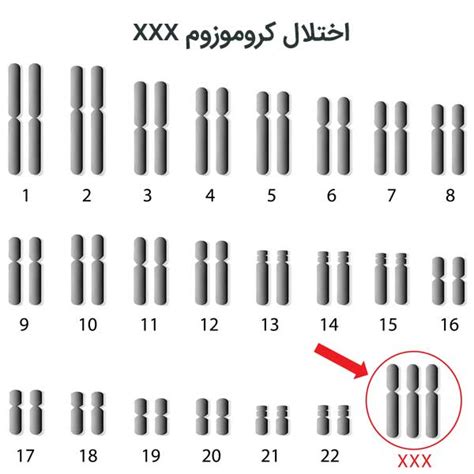 اختلال کروموزوم Xxx آزمایشگاه آرمین آزمایش خون