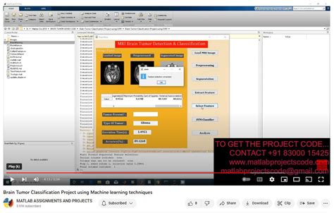 Brain Tumor Classification Project Using Machine Learning Techniques