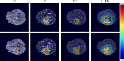 Figure 1 From Weakly Supervised Segmentation With Cross Modality